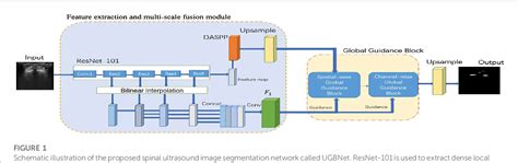 Figure 1 From Novel Automated Spinal Ultrasound Segmentation Approach For Scoliosis