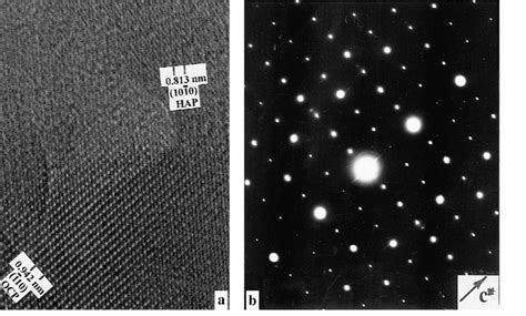 Hrtem Image Of The Ocp Like Mixed Crystal Where Both Ocp And Hap Download Scientific Diagram