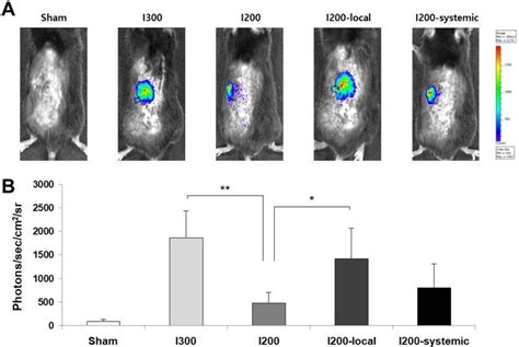 Local Pretreatment Of Islets With Liraglutide Is More Effective For