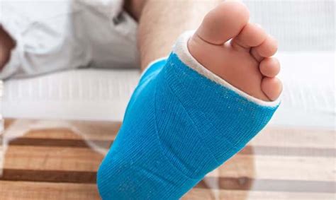 Foot Sprain Causes And Treatment Algcure