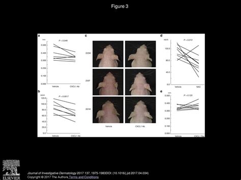Cxcl1 Inhibition Regulates Uvb Induced Skin Inflammation And