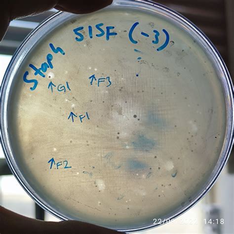 Staphylococcus Aureus Bacteriophage 152515f Mikroliz