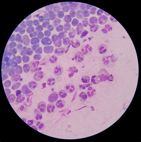 Кандида Микрофлора