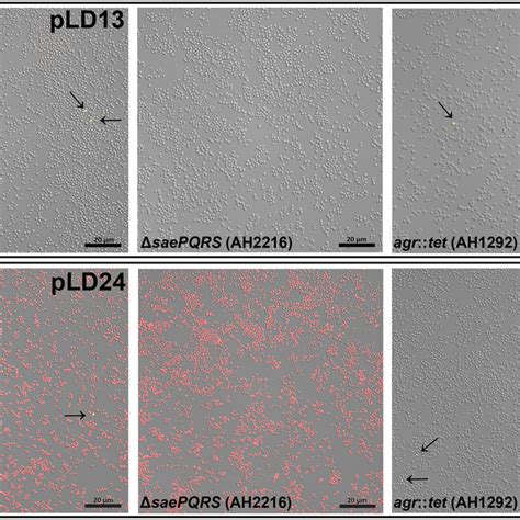 Effect Of The Saes P Allele On Expression Of Nuc S Aureus Strains