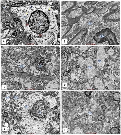 Electron Photomicrographs Of Sham Control Group A Astrocyte