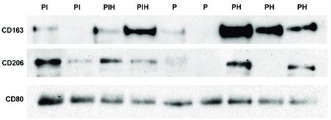 Representative Immunoblot Images Of The Analytes According To The