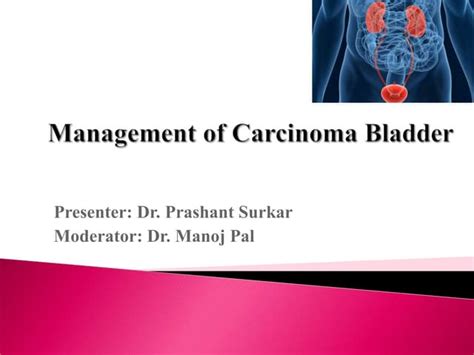 Ca Urinary Bladder Management Pptx