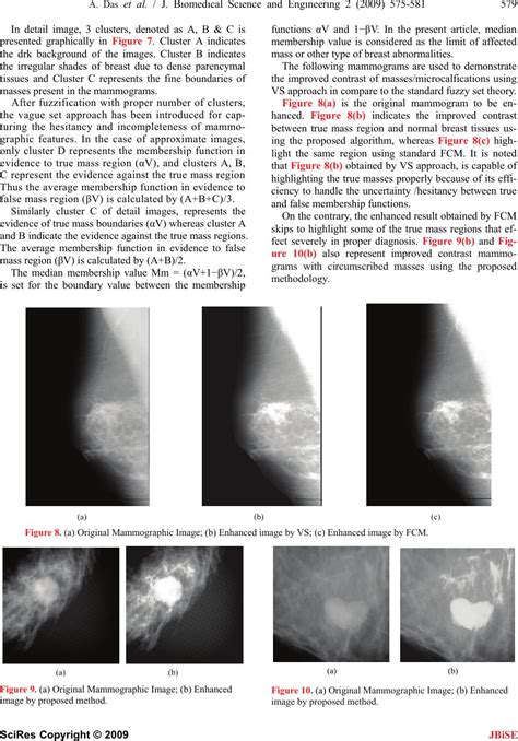 A Novel Vague Set Approach For Selective Contrast Enhancement Of Mammograms Using Multiresolution
