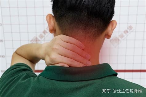 颈椎生理曲度变直、反弓怎么办？脖子底下枕个玻璃瓶可以改善吗？ 知乎