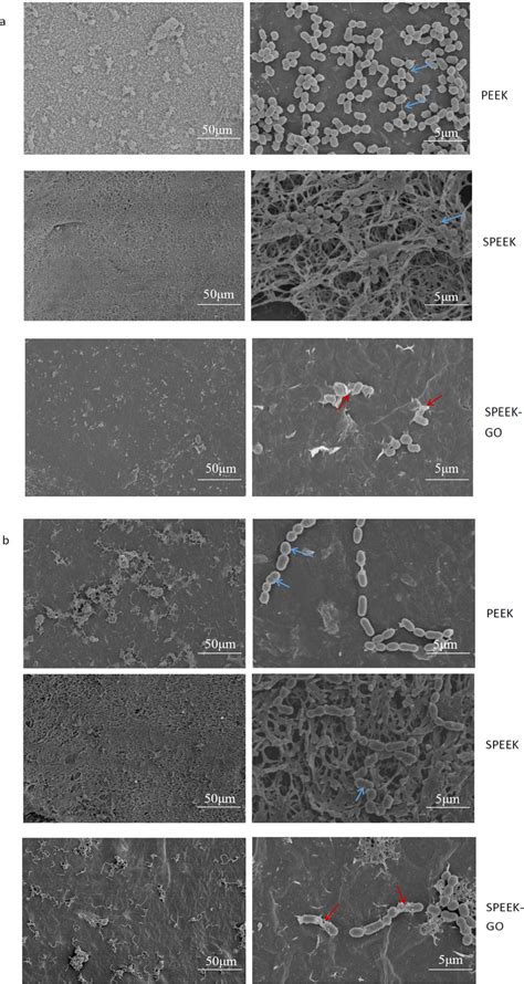 Sem Image Of Bacterial Biofilm On The Surface Of Specimens A Sem Image