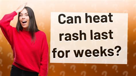 Can Heat Rash Last For Weeks Youtube