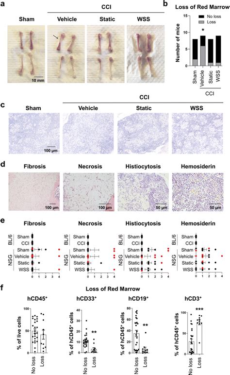 Brain Injury Is Associated With Bone Marrow Aplasia A Evidence For