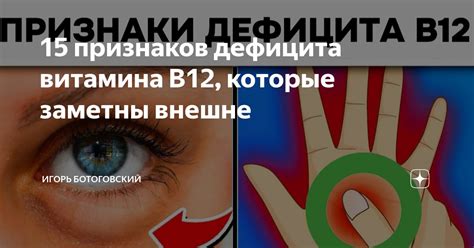 15 признаков дефицита витамина B12 которые заметны внешне Игорь Ботоговский Дзен