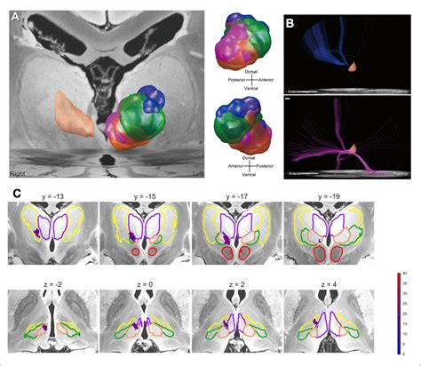 Figure 1 From Proceedings Of The 11th Annual Deep Brain Stimulation Think Tank Pushing The
