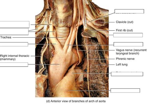 Human Neck Arteries Diagram Quizlet