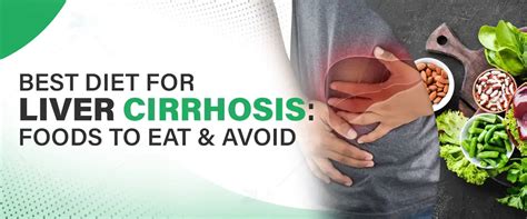 Best Diet For Liver Cirrhosis Foods To Eat And Avoid