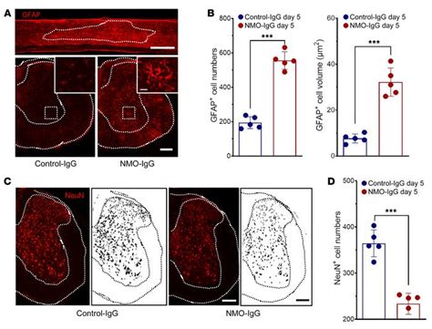 Jci Astrocyte Microglia Interaction Drives Evolving Neuromyelitis