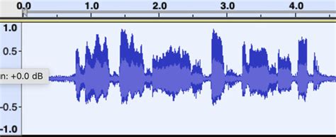 Phonocardiogram Microphone Clipart
