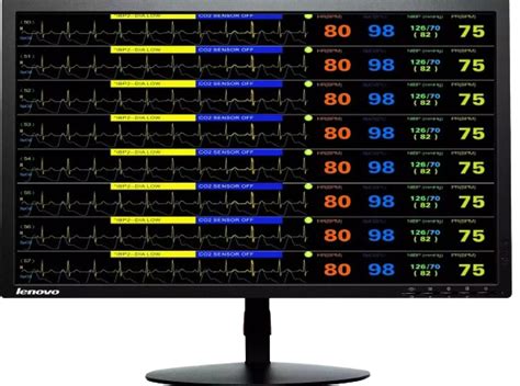 Pc Macs Series Next Step