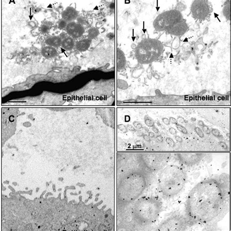 Pdf Gonococcal Cervicitis A Role For Biofilm In Pathogenesis