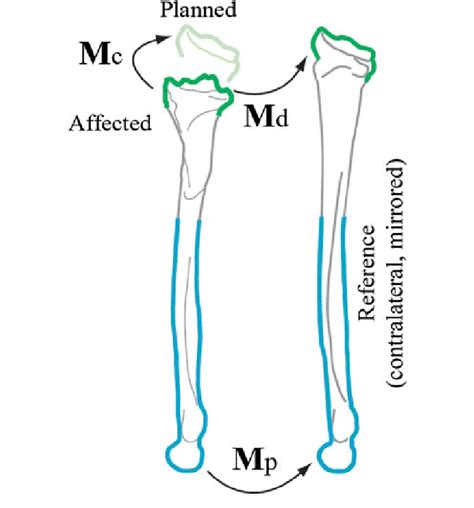 Proximal Vs Distal