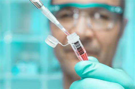 Inclusive Transform Trial Aims To Revolutionize Prostate Cancer