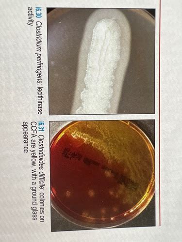 Anaerobic Gram Positive Bacilli — Spore Formers Flashcards Quizlet