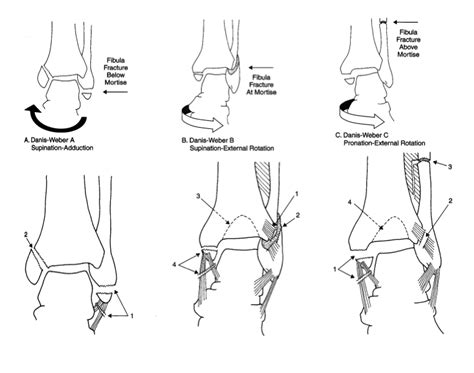 Core Em Ankle Stress Views Why When What Emdocs