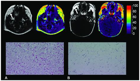 Post Mortem Mri And Histological Examinations Of The Bfp Mri And Download Scientific Diagram