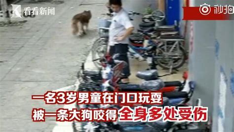 3岁男童遭大狗疯狂追咬缝了3针 狗主人狗打过疫苗 搜狐大视野 搜狐新闻