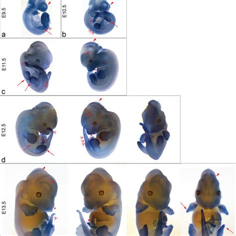 Mrna Expression Of Mthfd1l In Mouse Embryos In Situ Hybridization Of Download Scientific