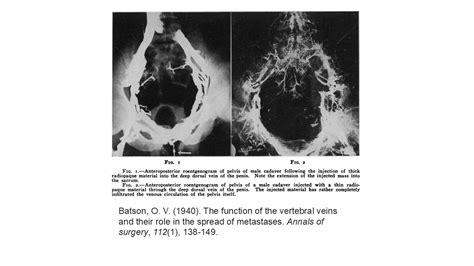 The Image Above This From An Excellent Paper Clearly Demonstrating The Broad Venous Connections