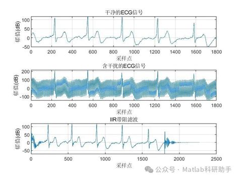 【心电信号】基于iir和fir滤波器实现心电图信号去噪附matlab代码用iir滤波器对心电信号进行滤波 Csdn博客