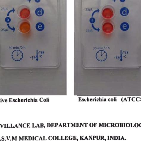 Pdf Evaluation Of The Rapidec Carba Np Test Kit For Detection Of Carbapenemase Producing Gram