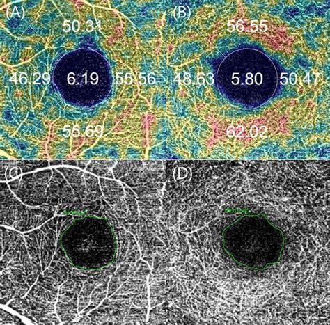 Placental Growth Factor Plos One