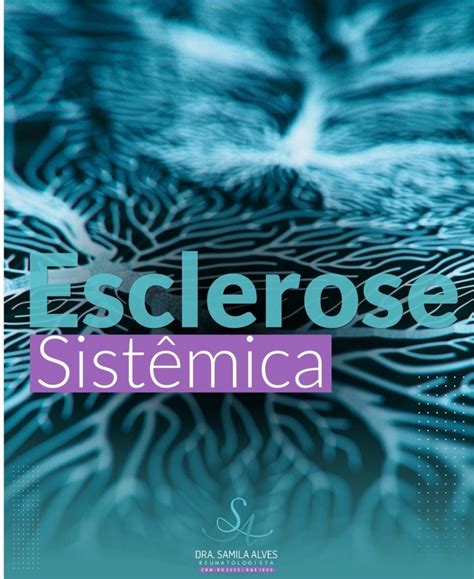 Esclerose Sist Mica Artrite Reumat Ide