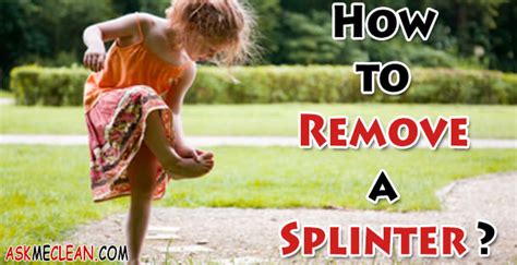 How To Remove A Splinter