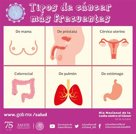 ‪conoce Los Tipos De Cáncer Más Secretaría De Salud