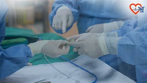 Angiography Vs Angiogram Key Differences Explained