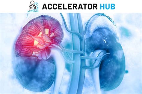 Prime® Online Activity Exploring The Latest Advances In The Diagnosis