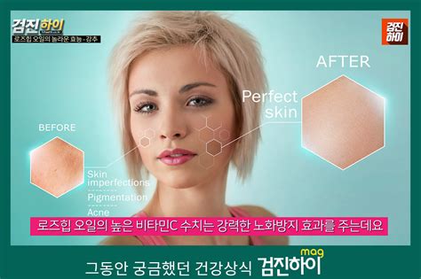 로즈힙오일이 주는 놀라운 효과 이건 강추해요~ 건강검진정보