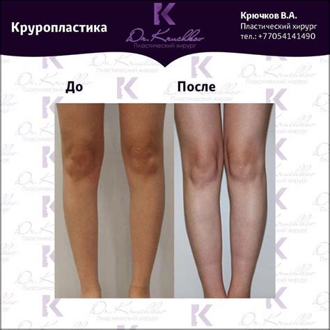 Пластический хирург Крючков Владимир Анатольевич 🔻 операция по