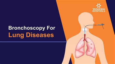 Bronchoscopy For Lung Diseases Ppt