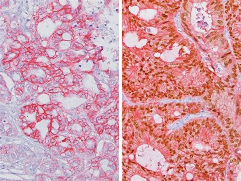 Multiplex Ihc™ Antibodies Biocare Medical