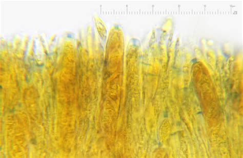 Ciborinia Sp ニセキンカクキン属 No 001