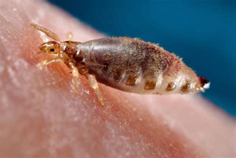 Common Human Skin Parasites Hubpages