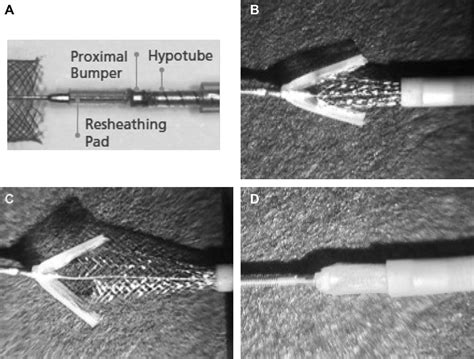 Multicenter Study Of Pipeline Flex For Intracranial Aneurysm Neurosurgery