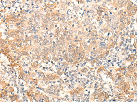 兔抗ahctf1多克隆抗体anti Ahctf1 Rabbit Polyclonal Antibody 生命科学产品与技术服务 生工生物工程