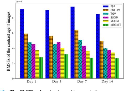 Figure 12 From Sparse View Spectral Ct Reconstruction And Material Decomposition Based On Multi