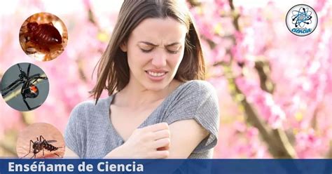 Conoce Las Diferencias Entre La Picadura De Una Chinche Un Mosquito Y